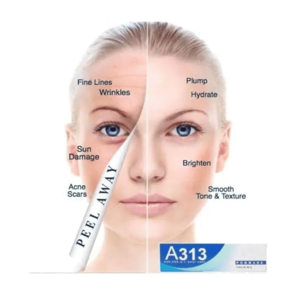 Unlock Radiant Skin with A313 Retinol Cream 50g – Your Local Pharmacy
